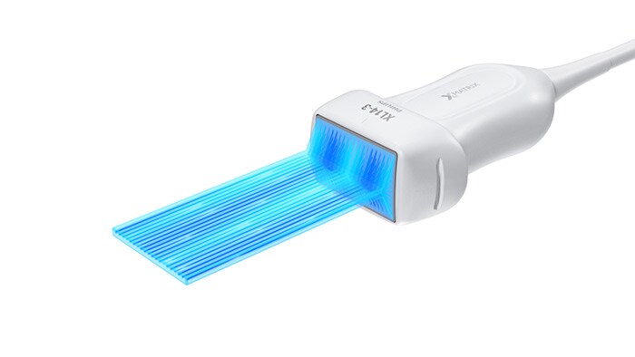 Vascular Ultrasound System Portfolio | Philips